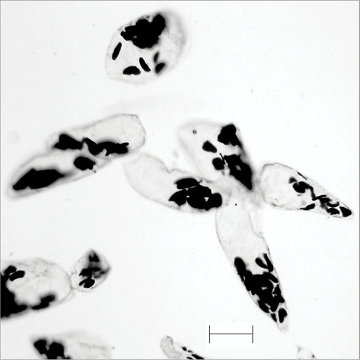 Exploring Carbohydrates with Bananas | The American Biology Teacher ...
